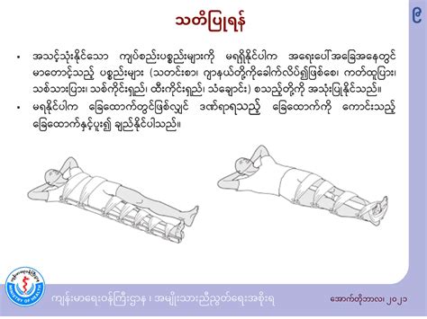 Fracture Management Poster Medical Family Mandalay