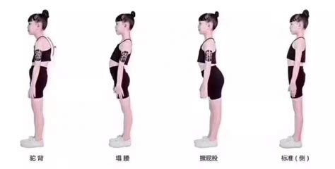 孩子的不良体态会随着年龄增加而消失，还是严重？可以通过儿童鞋垫帮助儿童体态发育吗？ 知乎
