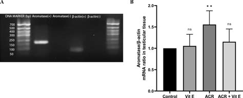 Analysis Of Aromatase Mrna Gene Expression In Testicular Tissue A