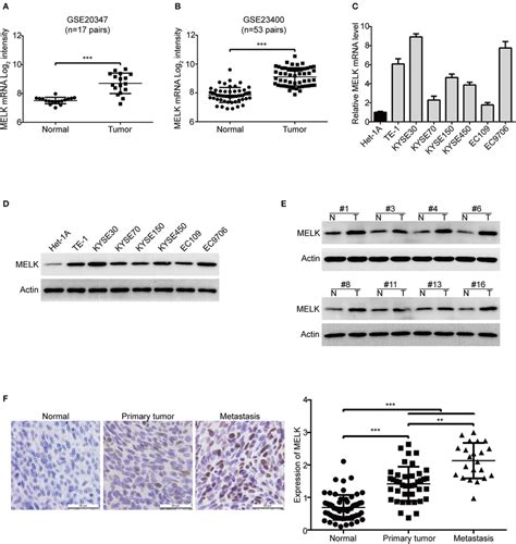 Melk Is Highly Expressed In Escc A B Melk Mrna Expression Was Download Scientific Diagram