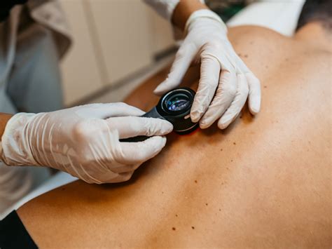 Driving Improved Outcomes In Resectable Melanoma Pathways For