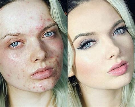 ЛЕГЕНДАРНЫЙ ТОНАЛЬНЫЙ КРЕМ Dermacol С ВЫСОКИМ МАСКИРУЮЩИМ ЭФФЕКТОМ