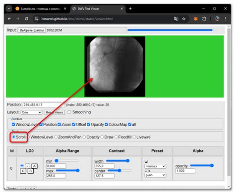 Чем открыть формат DCM