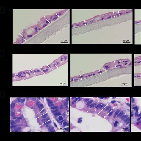 Infant Hies Have Shorter Epithelial Cell Height A Quantitation Of Cell