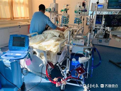 Ecmo