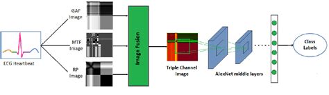 Figure 1 From Ecg Heartbeat Classification Using Multimodal Fusion Semantic Scholar