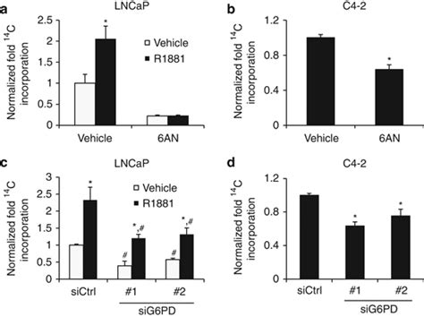 G6pd Regulates Ribose Synthesis In Prostate Cancer Cell Models A And