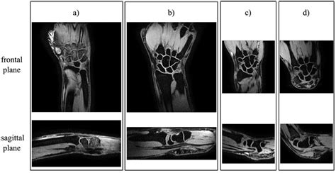 Visualization Of Slices Taken From Examples Of The Dataset Including