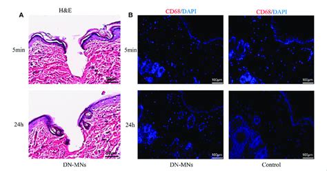 In Vivo Biocompatibility Of Dn Mns A Hande Staining Of Skin Tissues