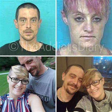 How Drug Addiction Looks Before And After 40 Pics