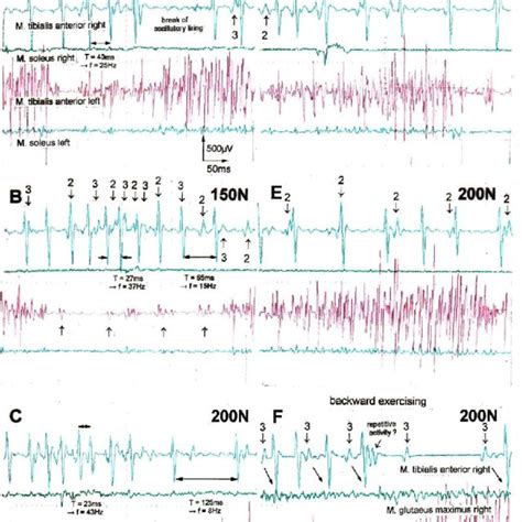 The Cognitive Panic Cycle Formulation Developed With Paul Based On The Download Scientific