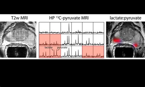 Body Research Interest Group Rig