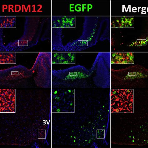 Hypothalamic Pomc Expression Is Impaired In Prdm12 Knockout Mice A