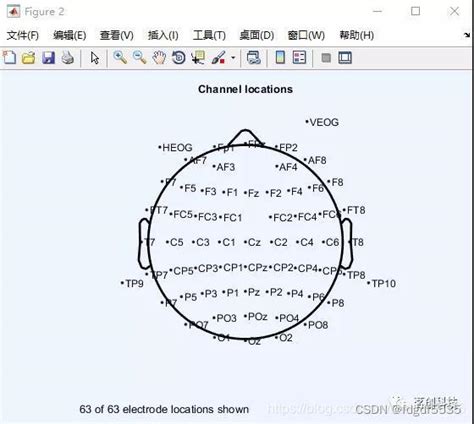 手动使用eeglab进行脑电数据预处理ui过程函数调用代码批处理脑电数据预处理history Csdn博客