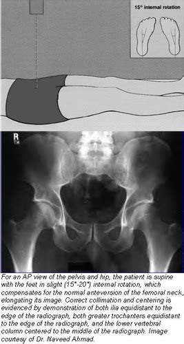 Positioning Pelvis Hip Si Joints Flashcards Quizlet