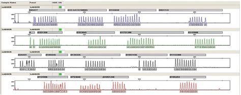Figure 2 From A New Multiplex Assay Of 17 Autosomal Strs And Amelogenin For Forensic Application