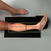 Radiographic Positioning Of The Femur And Tib Fib CE RT