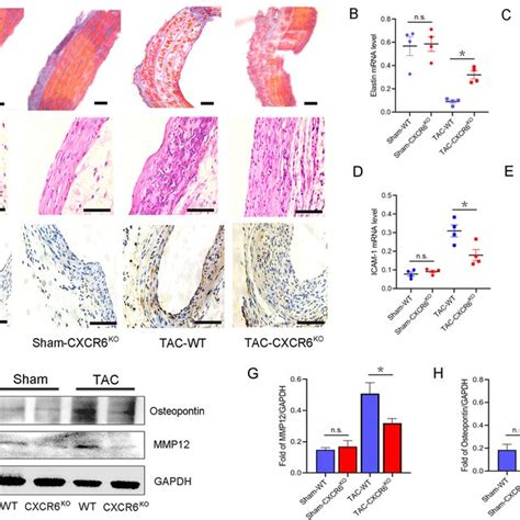 Macrophage Infiltration In The Aorta Of Cxcr6−− Mice Was Attenuated In