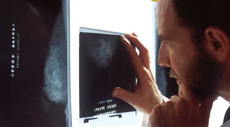 Factores De Riesgo Para Padecer Cáncer Mi salud en Línea