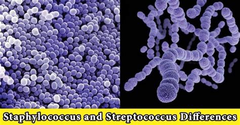 Staphylococcus Vs Streptococcus 20 Major Differences