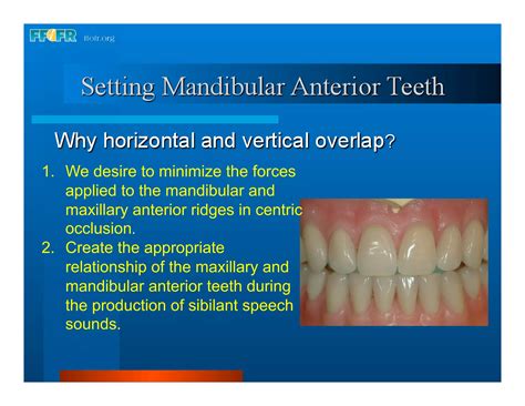 16 Occlusal Schemes Lingualized Occlusion Pdf
