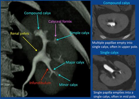 Genitourinary Learning Modules Ct Scanning