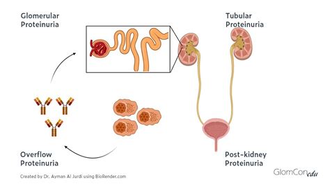 Classifications Of Proteinuria Types Of Proteinuria Youtube
