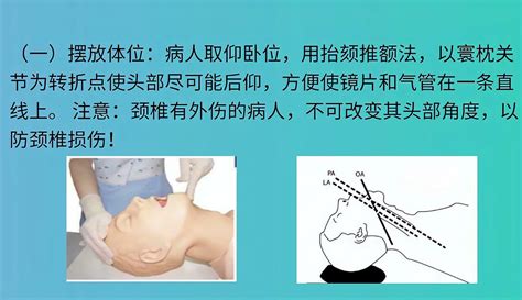 气管插管操作步骤 知识 名师课堂 爱奇艺