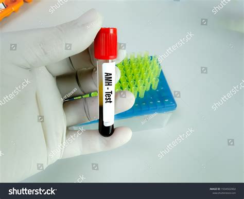 Blood Sample Tube Hormone Amh Test Stock Photo 1934502002 Shutterstock