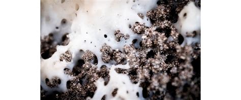 Bone Ingrowth Into The Porous Coated Surface Of An Uncemented Cup