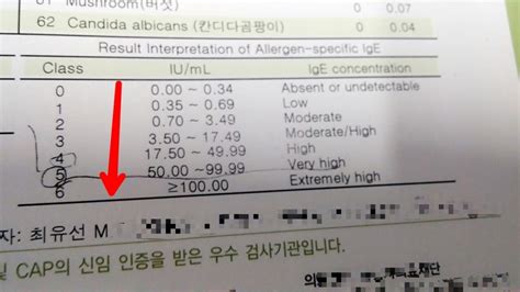 알레르기알러지 검사♪ 비용병원결과~ 네이버 블로그