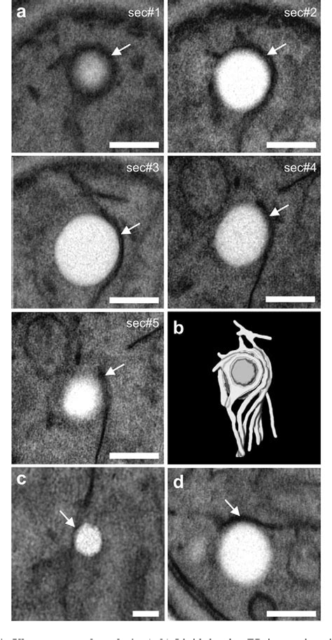 Figure 5 From A Role For Seipin In Lipid Droplet Dynamics And