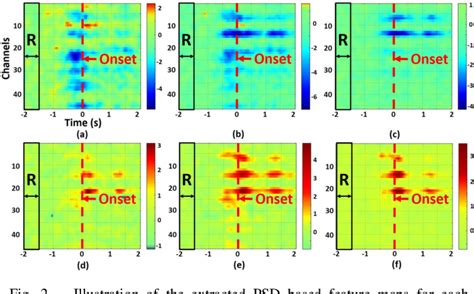 Figure 2 From Decoding Of Hand Gestures From Electrocorticography With