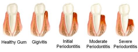 Dentist Dublin Periodontology