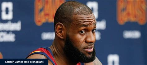 Lebron James Hair Transplant Smile Hair Clinic