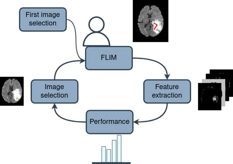 Interactive Image Selection And Training For Brain Tumor Segmentation Network Ai Research
