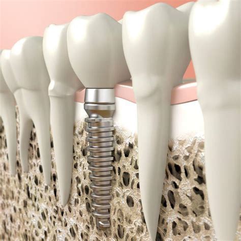 Central Florida Institute Of Oral Surgery And Dental Implants Winter