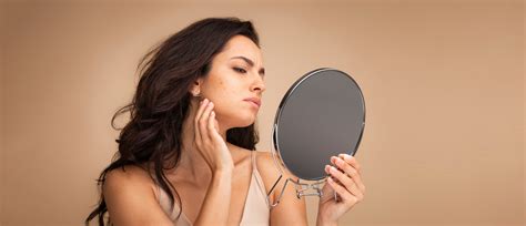 Acneea Tipuri Tratament Preventie Blog