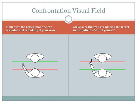 What Is Confrontational Visual Field Testing At Georgia Kirsova Blog