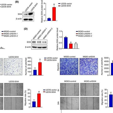 SIX4 Is Important For The Migration Of Osteosarcoma Cells A PCR