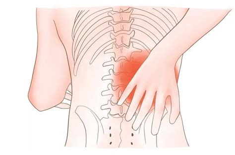 得了腰肌劳损怎么办？腰肌劳损最全攻略，你想知道的都在这里！（上） 知乎