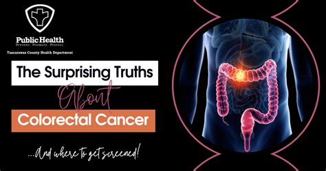 The Surprising Truths About Colorectal Cancer And Where To Get Screened Newsymom