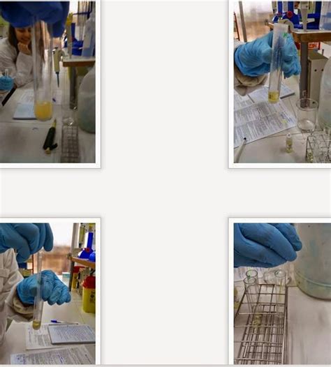LABORATORIO DE DIAGNÓSTICO CLÍNICO Capacidad de fijación total de hierro