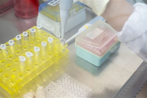 Eppendorf Tube Imagens Procure 1 491 Fotos Vetores E Vídeos
