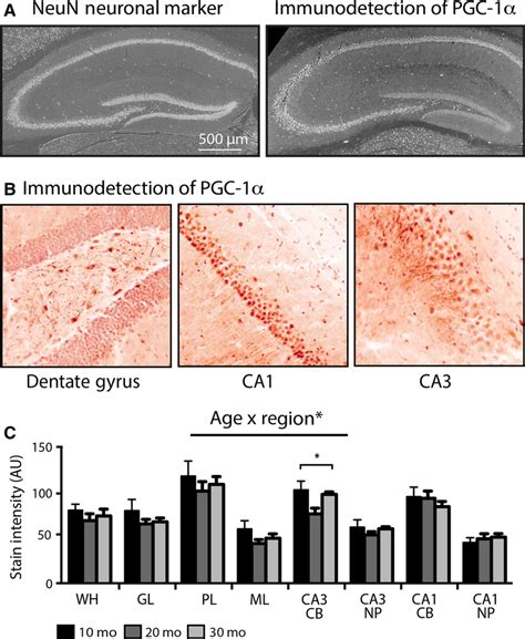 Regional differences in PGC α protein expression and the impact of Download Scientific Diagram