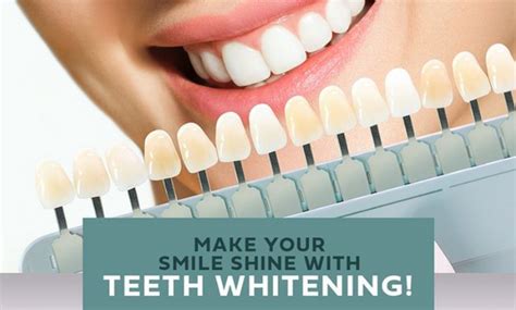 Teeth Whitening Westpark Dental Groupon