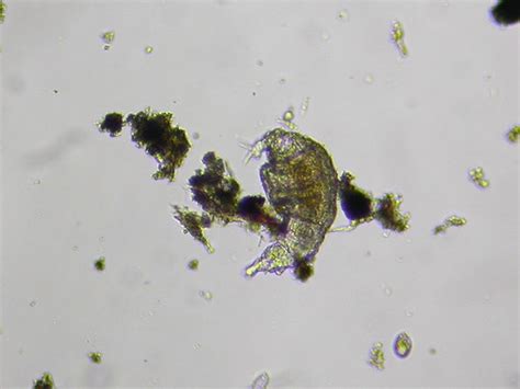 Bdelloidea Sp Bdelloidea Sp Washed From Sample Of Cerat… Flickr