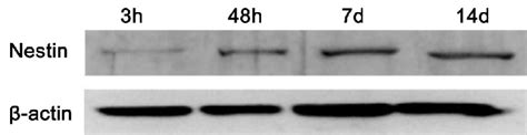The Expression Of Nestin In Rat Retina After Optic Nerve Transection Download Scientific Diagram