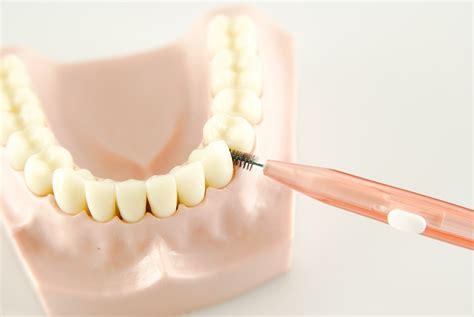 Interdental Brushing Dental Treatments The Dental Surgery