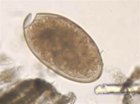 Helminths Flashcards Quizlet